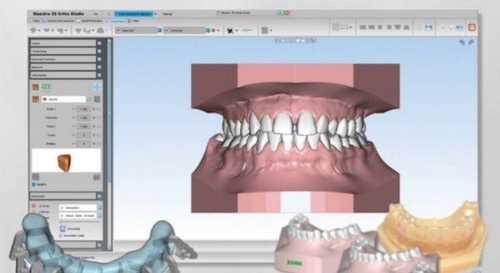 Maestro 3d ortho studio