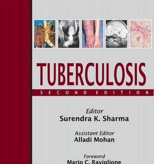 Туберкулез книга. Tuberculosis книга. Книги про туберкулез лежат на столе.