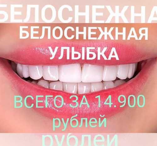 Съемные виниры