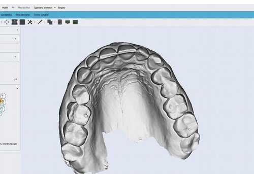 Maestro 3D dental studio версия 6.0
