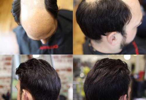 Парик для мужчин система замещения волос