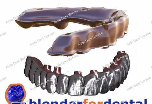 Blender for dental (B4D) iBar (балки) и все модули