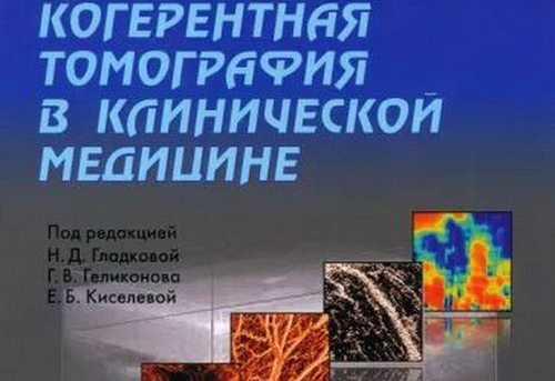 Мультимодальная оптическая когерентная томография