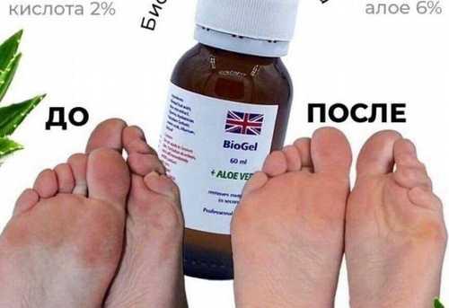 Биогель Алоэ Вера