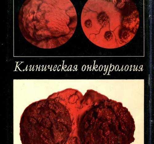 Клиническая онкоурология