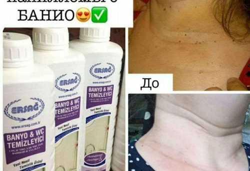 Эрсаг (Турция)