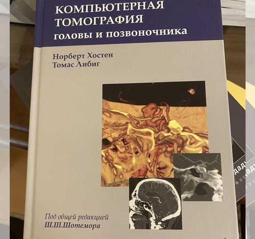 Компьютерная томография головы хостен