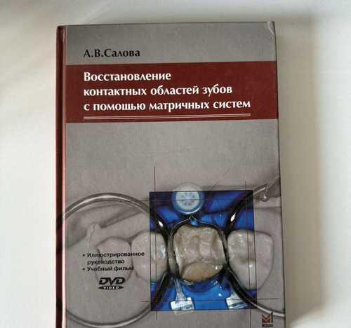 Восстановление контактов зубов матрицей