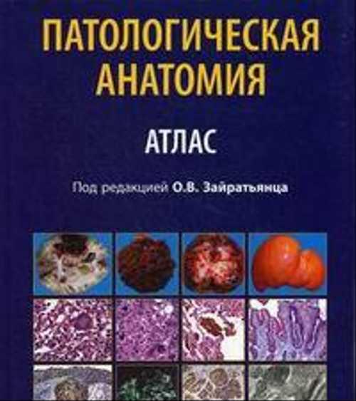 Учебник по патанатомии. Патологическая анатомия Зайратьянц. Патологический атлас Зайратьянц. Патологическая анатомия атлас.