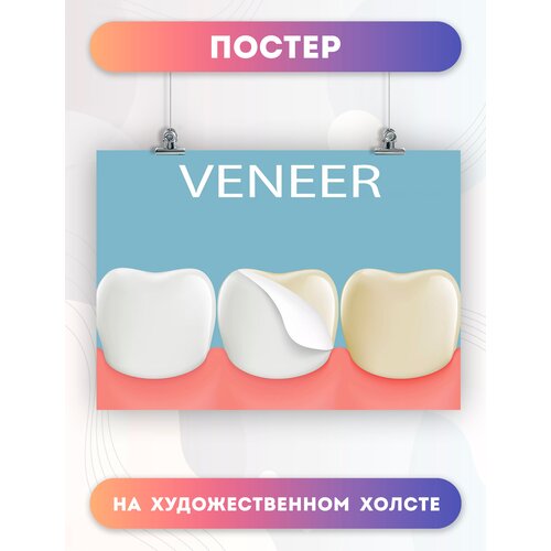 Постер на холсте Стоматология Виниры (3) 40х60 см