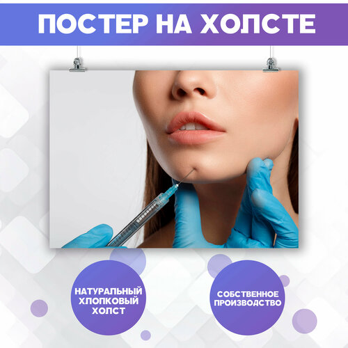Постер на холсте Косметология Салон красоты Увеличение губ Мезотерапия Уход за лицом (2) 60х80 см