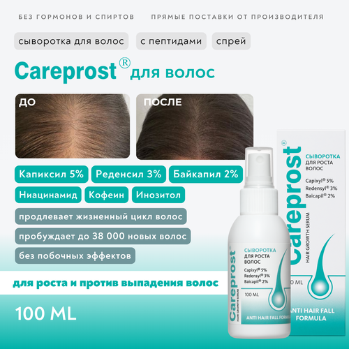 Сыворотка для роста волос Careprost (Карепрост), Капиксил 5%, Реденсил 3%, Байкапил 2%